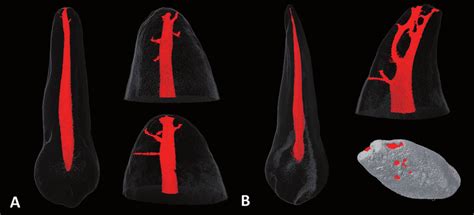 Representative Micro Ct Tridimensional Reconstructions Showing A