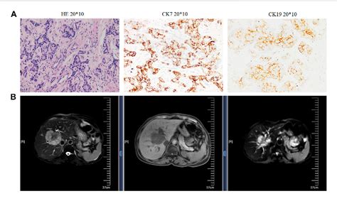 Figure 1 From The Expression Profiles Of Circular Rnas And Competing