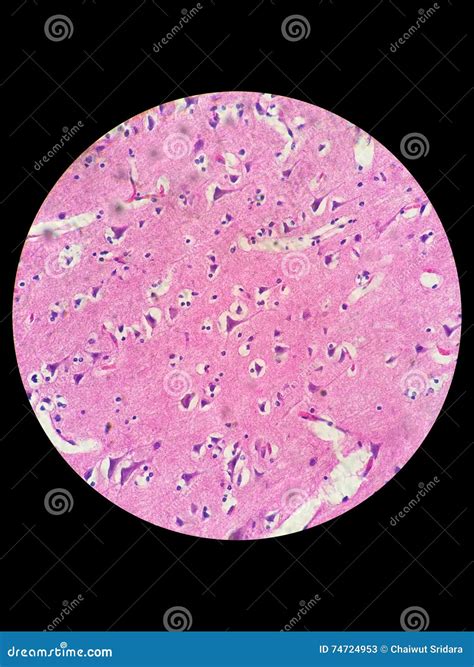 Nervous Tissue Microscope Slide Micropedia