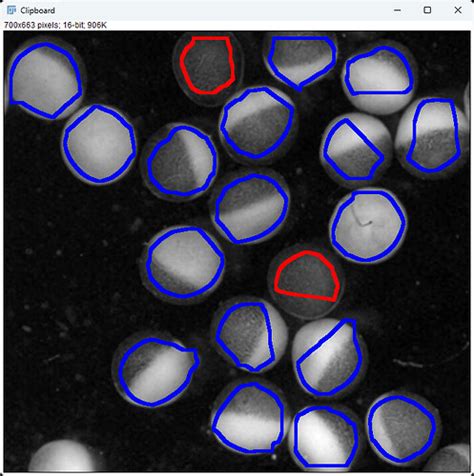 Help With Imagej Analysis Counting Specific Objects Image Analysis Imagesc Forum