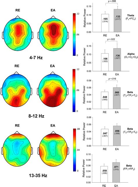 The Pooled Topological Spectral Mapping Of Scalp Eeg At Theta 4 7 Hz Download Scientific