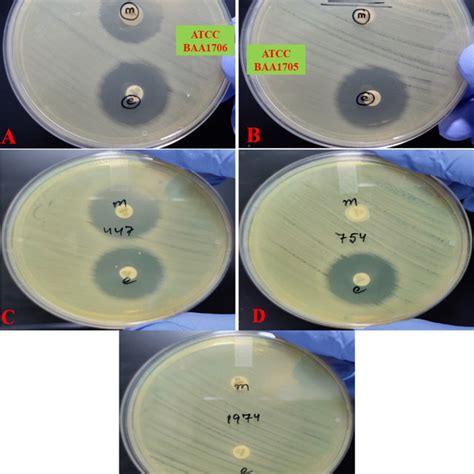 Pictorial Demonstration Of Modified Carbapenem Inactivation Method Download Scientific Diagram