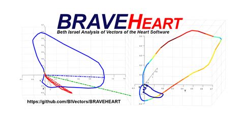 Electrocardiogram GitHub Topics GitHub