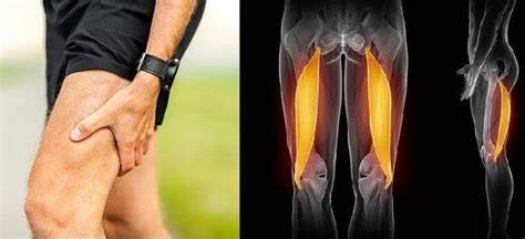 Hamstring Injuries Could Be Implementing Other Issues El Paso TX Sciatica Pain And