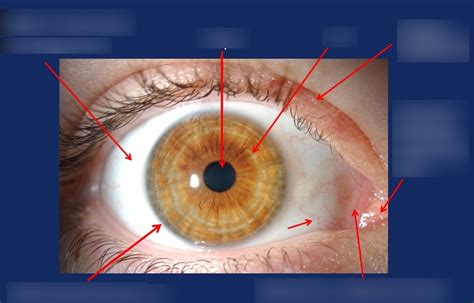 External Eye 2 Diagram Quizlet
