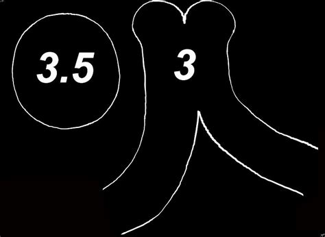 05 02 23 Conotruncal Abnormalities Heart