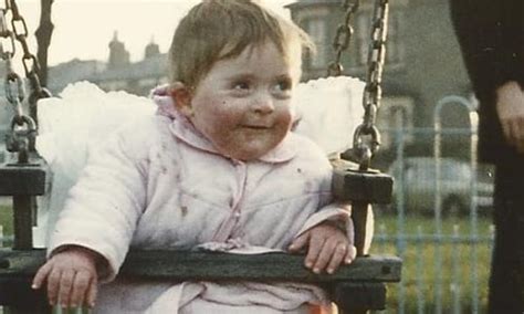 Denise Downs Syndrome Association