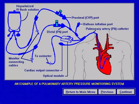 Hemodynamic Monitoring Ppt Pptx First Aid Injuries