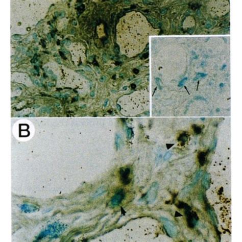 Clust Apoj Expression By M ~ Double Labeling Of Sections With Apoj Ab