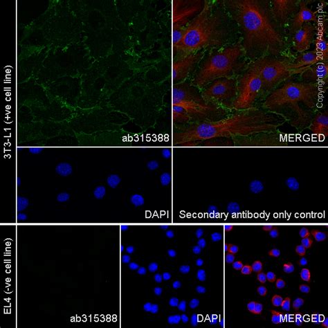 Anti Osmr Antibody [epr28222 64] Ab315388 Abcam