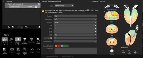 Mr Prostate Ai Based Segmentation And Classification