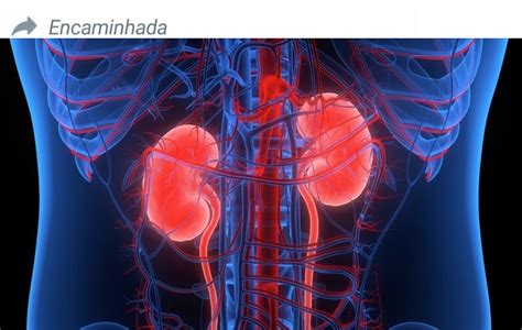 Insuficiência Renal Aguda Ira Arte No Papel Online