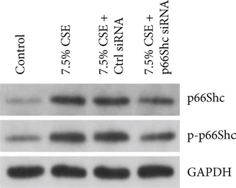 P66shc Silencing Improved Cse Induced Mitochondrial Dysfunction Of