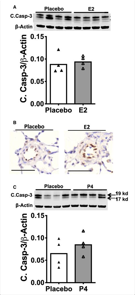 Loss Of Protective Effects Of Female Sex Hormones On Endothelial Cell Download Scientific