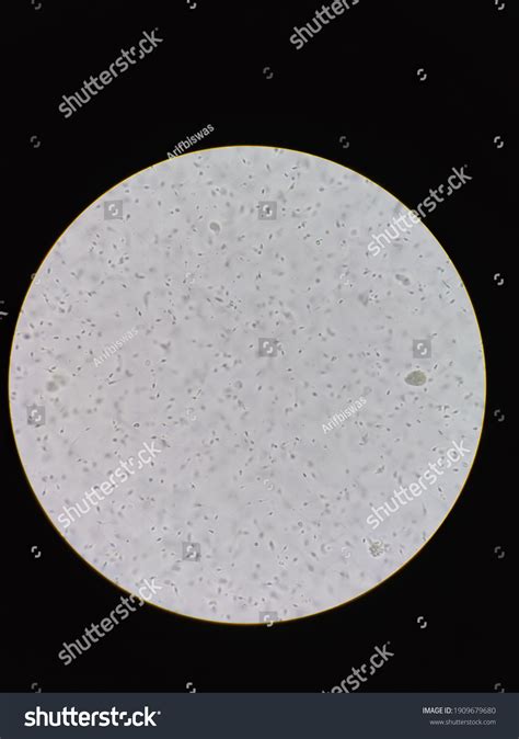 Sperm Microscope 40x