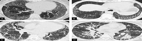 Journal Of Thoracic Imaging