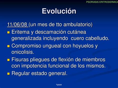 Ppt Psoriasis Eritrod É Rmica Powerpoint Presentation Free Download