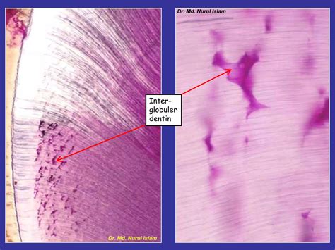 Dentin Pulp Complex Pptx