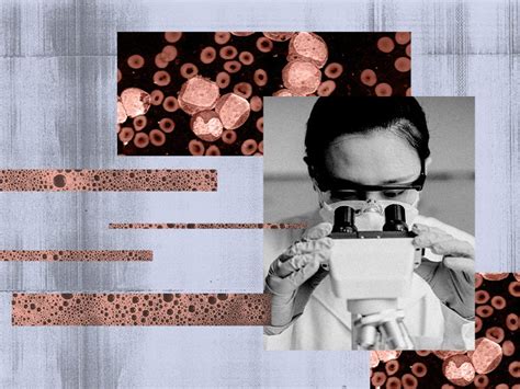 What Tests Can Diagnose And Stage Aml What Tests Can Diagnose And Stage Aml