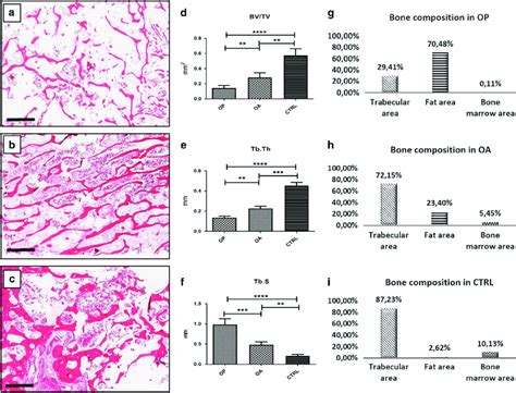 Evaluation Of Bone Morphometric Parameters Hande Sections Of Bone Head