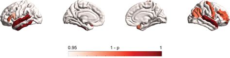 Figure 3 From Association Between Structural Brain Mri Abnormalities And Epilepsy In Older