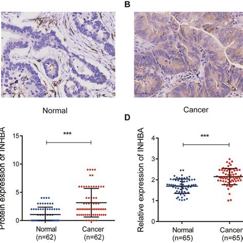 The Oncomine Database Was Used To Determine Protein And Mrna Expression
