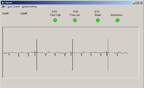 general view of the algorithm for qrs detection and ectopic beats