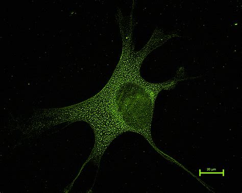 Mitofusin 1 Antibody Bsa Free Nbp1 51841 Novus Biologicals