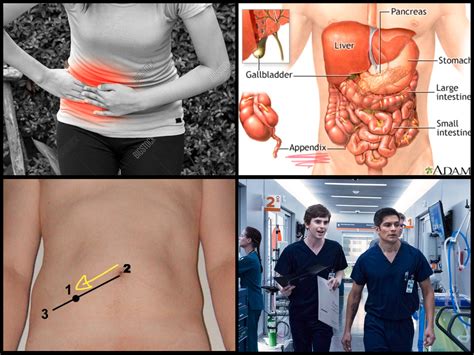 Gallbladder And Appendix Location