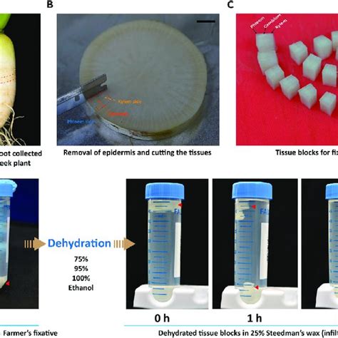 Microscope Views Of Radish Root Cross Sections Used For Laser Capture