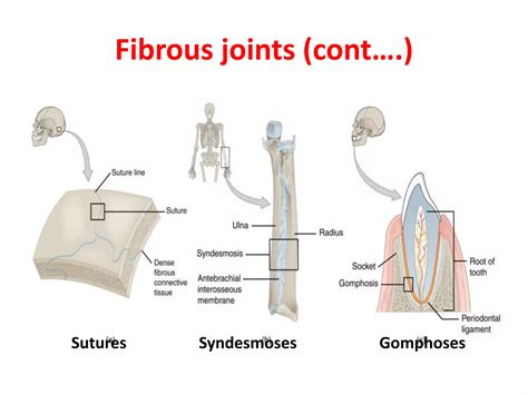 Classification And Applied Aspects Of Joints Pptx