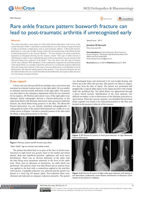 Rare Ankle Fracture Pattern Bosworth Fracture Can Lead To Post