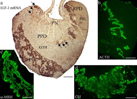 Localisation Of Igf I Mrna And Classical Adenohypophyseal Hormones On Download Scientific