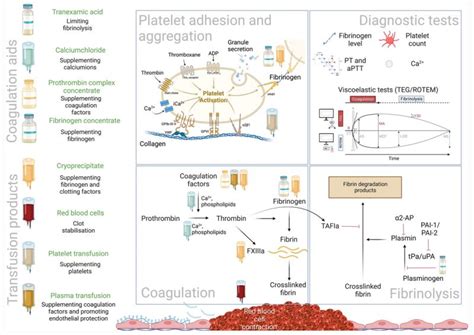Rob Mac Sweeney On Linkedin Coagulation Support During Perioperative Bleeding Management Ccr