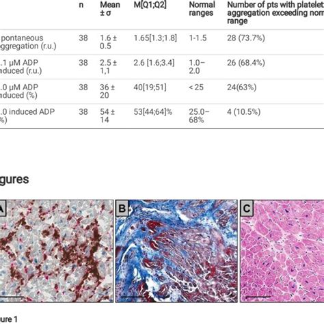 Platelet Aggregation In Dcm Patients Download Scientific Diagram