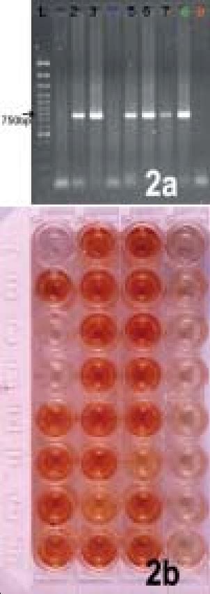 A Rt Pcr For N Gene On Saliva Samples Taken From Rabies Patients B