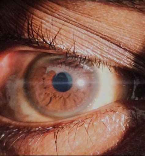 Anelli Kayser Fleischer Untitled