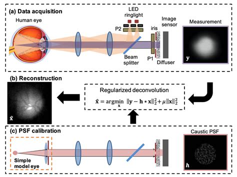 Computational Ophthalmic Imaging Tian Lab