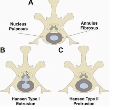 Spinal Cord Flashcards Quizlet