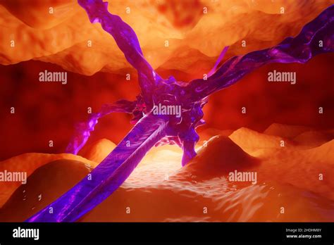 Tissue Tumor Endoscopy Tissues Tumors Endoscopies Stock Photo Alamy