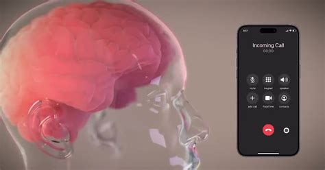 머스크 인간 뇌에 칩 이식뇌 컴퓨터 연결 임상 시작