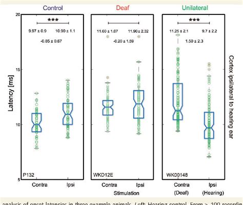 Figure 4 From Single Sided Deafness Leads To Unilateral Aural Preference Within An Early