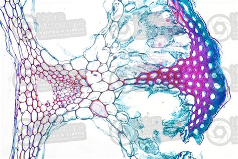 Equisetum Litorale Sterile Stem Vascular Bundle Transverse Section 250x Sterile Stem