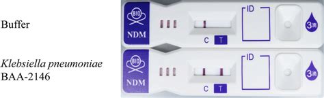 Immunochromatography Using Mabs 1e2 7 And 4e4 4 In Negative Cases A Download Scientific