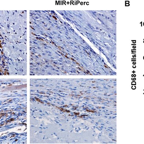 Effect Of Remote Ischemic Perconditioning On Influx Of Cd68 Cells Download Scientific