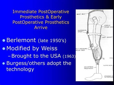 Ppt History Of Postoperative Prosthetics Surviving Lower Extremity