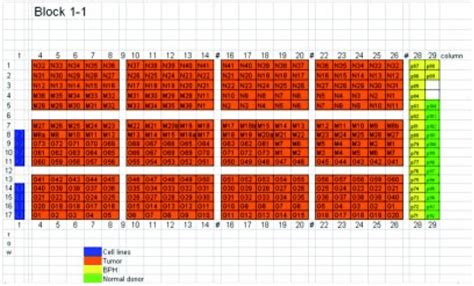Tissue Microarray Map Bph Benign Prostatic Hyperplasia Download