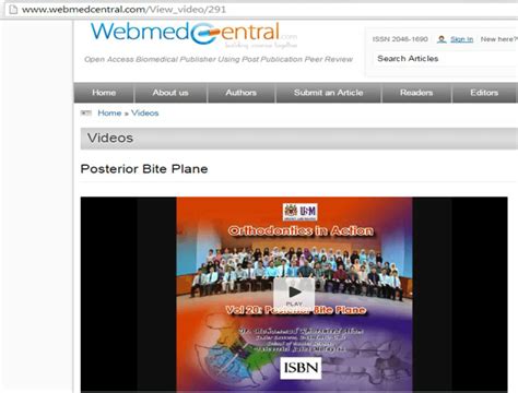 Pdf Construction Of Posterior Bite Plane