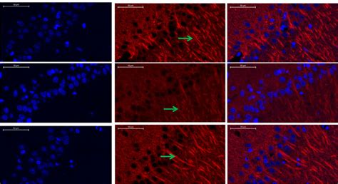 Map2 Immunohistochemistry Staining In Hippocampal Ca1 Region Of 2 Vo