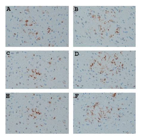 Representative Pictures Of Thioflavin S Stained Aβ Plaques Lightly